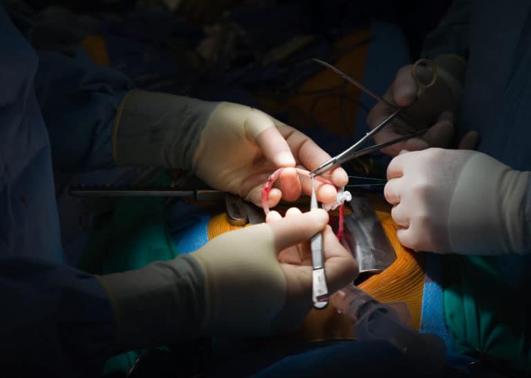 Coronary artery Bypass Surgery - Dr Diana Holdright